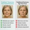 TrueEase™ Custom-Fit Functional Dentures — Perfectly Fitted in Minutes ...
