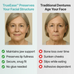 TrueEase™ Custom-Fit Functional Dentures — Perfectly Fitted in Minutes ...