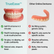 TrueEase™ Custom-Fit Functional Dentures — Perfectly Fitted in Minutes ...