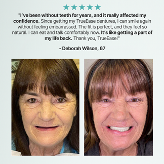 TrueEase™ Custom-Fit Functional Dentures — Perfectly Fitted in Minutes ...