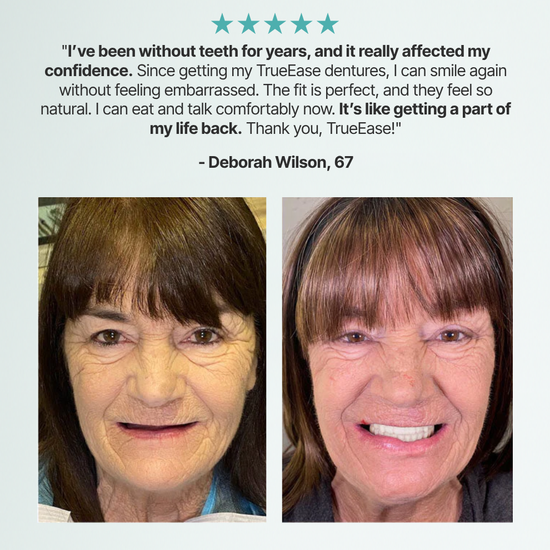 TrueEase™ Custom-Fit Functional Dentures — Perfectly Fitted in Minutes ...